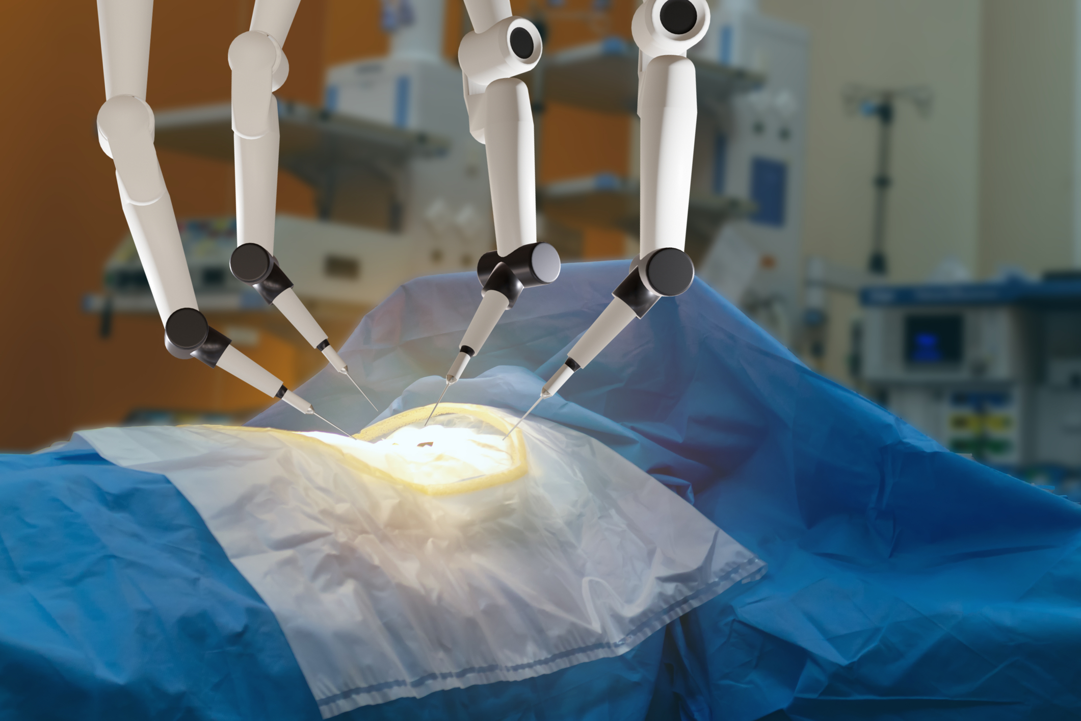 Handing the surgeon’s scalpel to a robot - Medmic